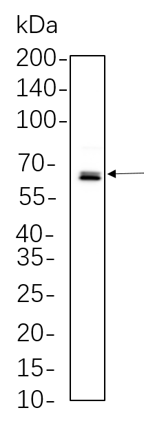 Rabbit Monoclonal Antibody to NF-κB p65 (Phospho Ser536)_一抗_抗体_产品_湖北艾普蒂 ...